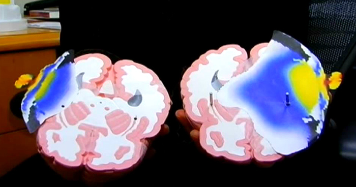 This Is What Wifi, Cell Phones, Ipads & More Are Doing To Your Child’s ...