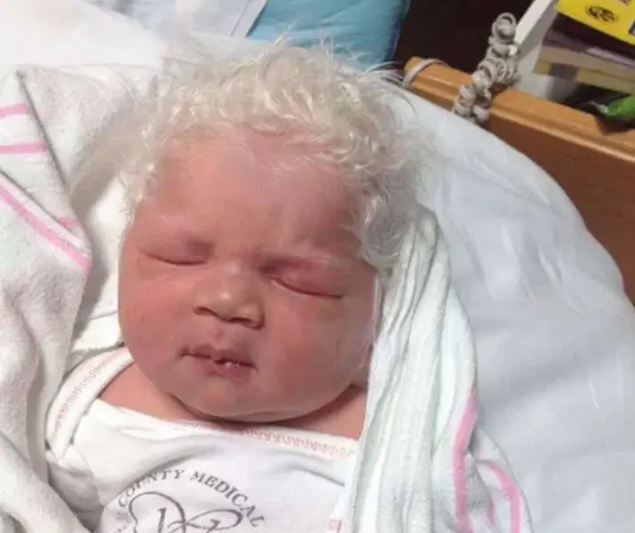 When The Baby Is Born With Snow-White Hair, The Parents Are Unsure Of ...