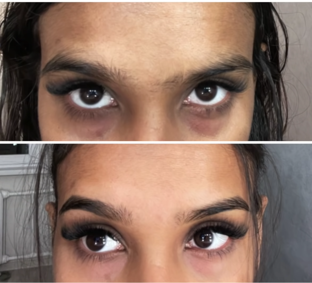 Woman Holds A Cold Spoon To Her Face Every Day. Women Go Ballistic When ...