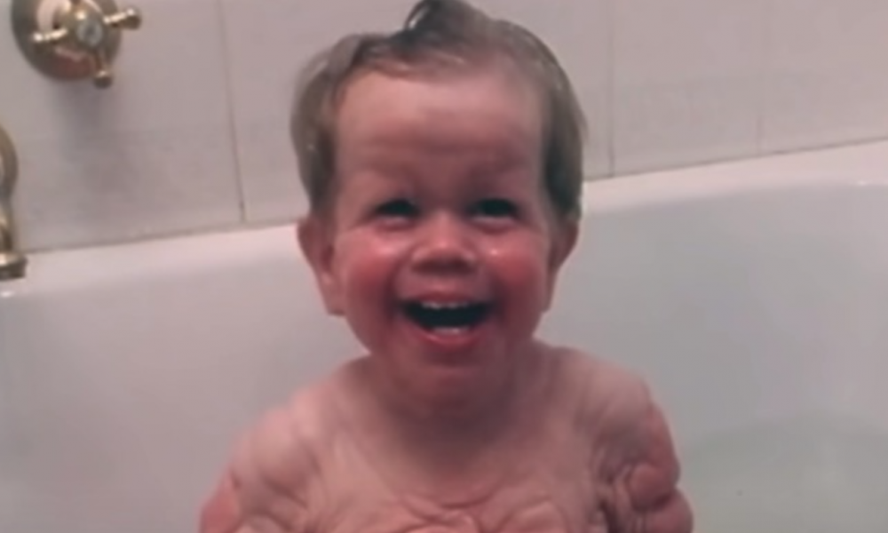 In 1993, This Boy Was Born With Enough Skin For A Five-Year-Old. But ...