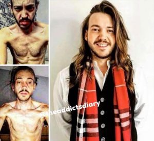‘The Addict’s Diary’: 25 Powerful Before & After Transformations Of ...