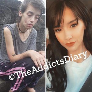 ‘The Addict’s Diary’: 25 Powerful Before & After Transformations Of ...