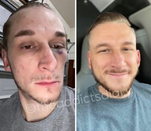 ‘The Addict’s Diary’: 25 Powerful Before & After Transformations Of ...