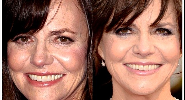After Undergoing Face Surgery, Sally Field Felt “Young Again” Since Her ...