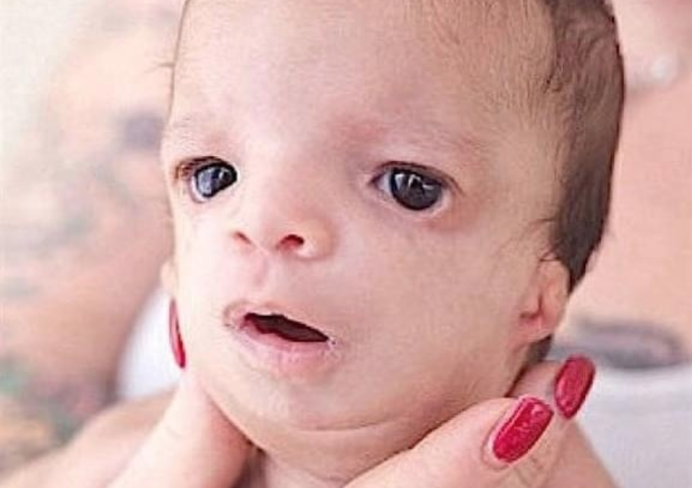 Woman Gives Birth To A Baby Daughter With Rare Condition And Is Puzzled ...
