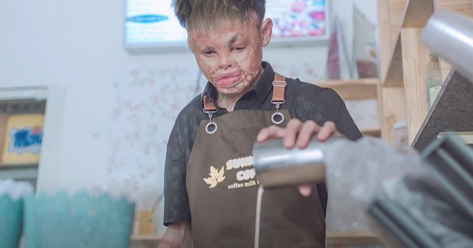 Unbelievable Story About A Boy With Facial Deformities Who Beat The Odds