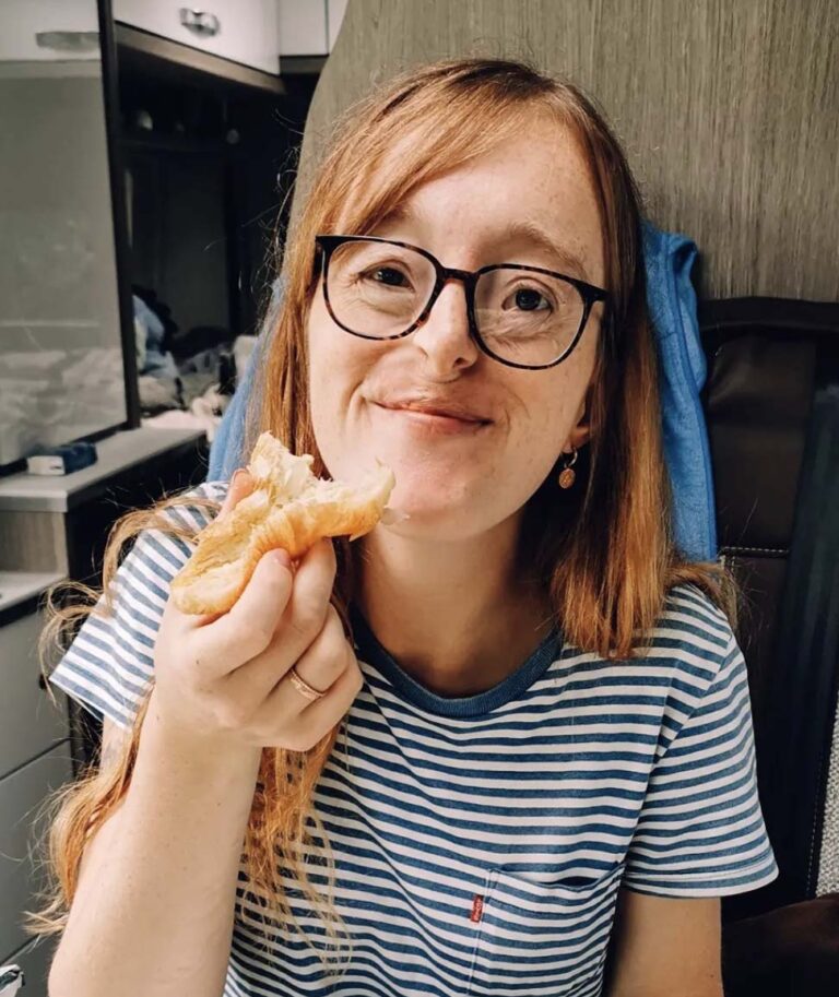 Ilka Brühl Was Born With Rare Facial Defect – But Wait Till You See Her ...