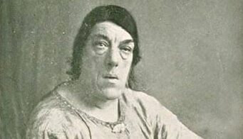 The Tragic Story Of Mary Ann Bevan, The So-Called ‘Ugliest Woman In The World’