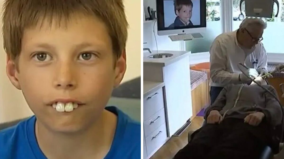 His Classmates Called Him “Rabbit Boy” – But Wait Till You See Him Now