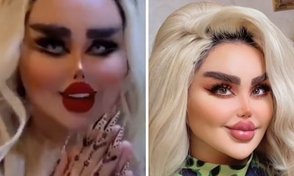 She Had 43 Cosmetic Procedures To Become A Barbie Doll - But Critics ...