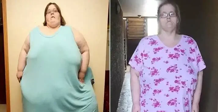 My 600lb Life Star Reveals Stunning Weight Loss After Suffering From ...