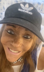 Patricia Krentcil The "Tan Mom" Almost Lost Her Life – This Is What She ...