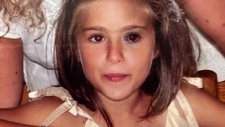 She Spent Years Covering Her Face With Makeup, Now She Wants To Reveal ...