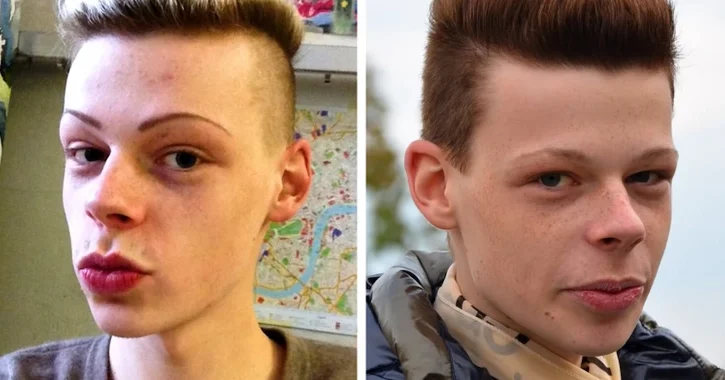 Meet Patrick Mast, Who Spent $73,000 To Look Like a Doll, But Wait Till You See The End Result