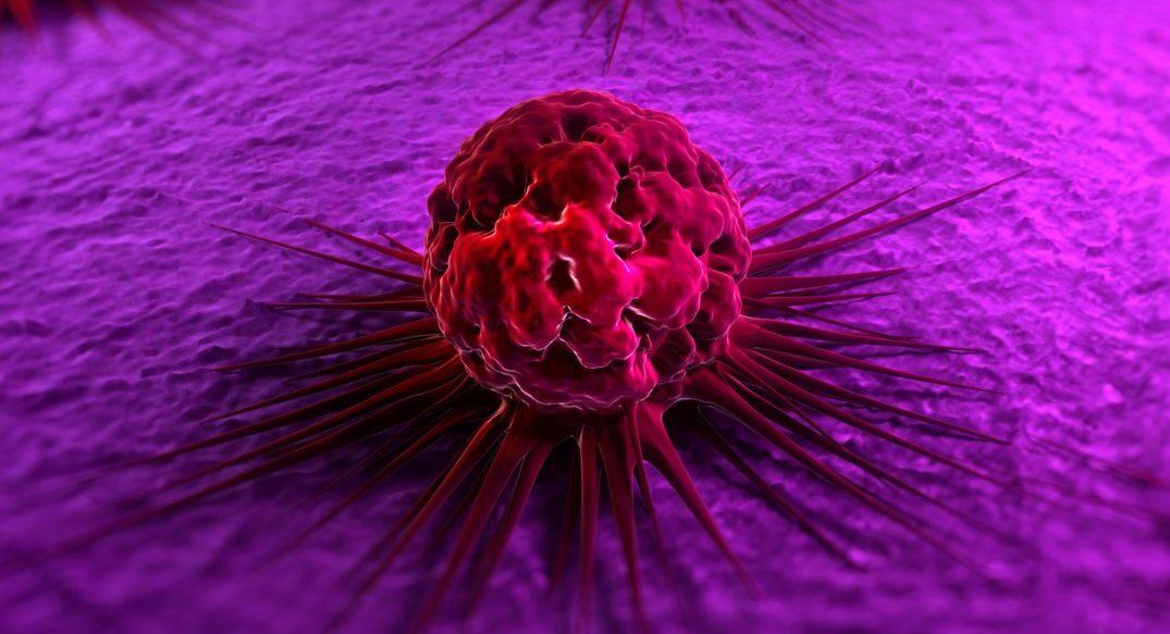 If You Spot These 20+ Signs Cancer May Be Growing In Your Body