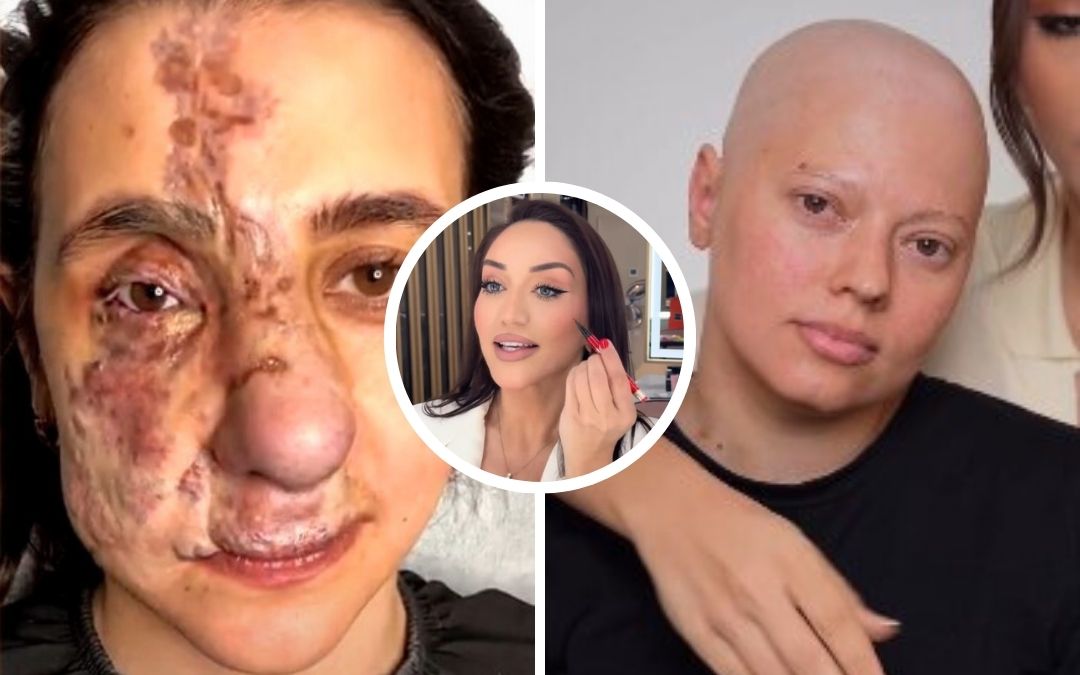 Goar Avetisyan: The Artist Who Turns Pain Into Beauty